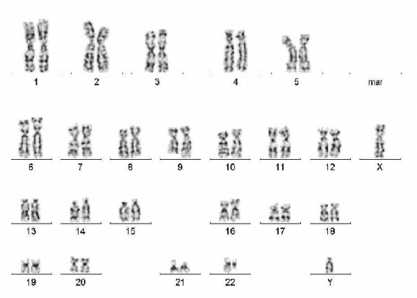 Hämatologie & Onkologie - Labor Berlin